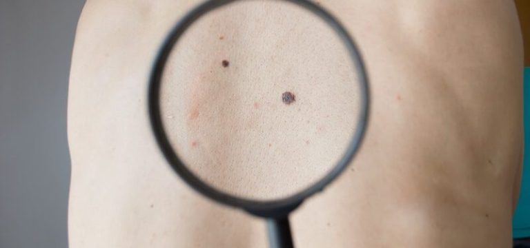 Dermatologie - Clinique La Vallée