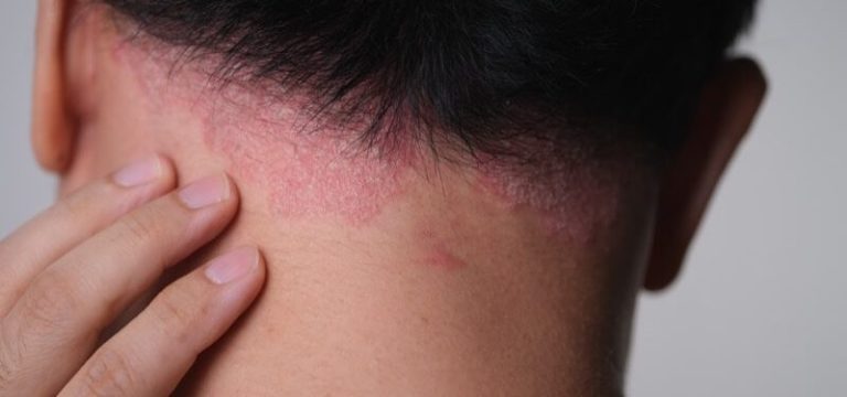 Dermatologie - Clinique La Vallée